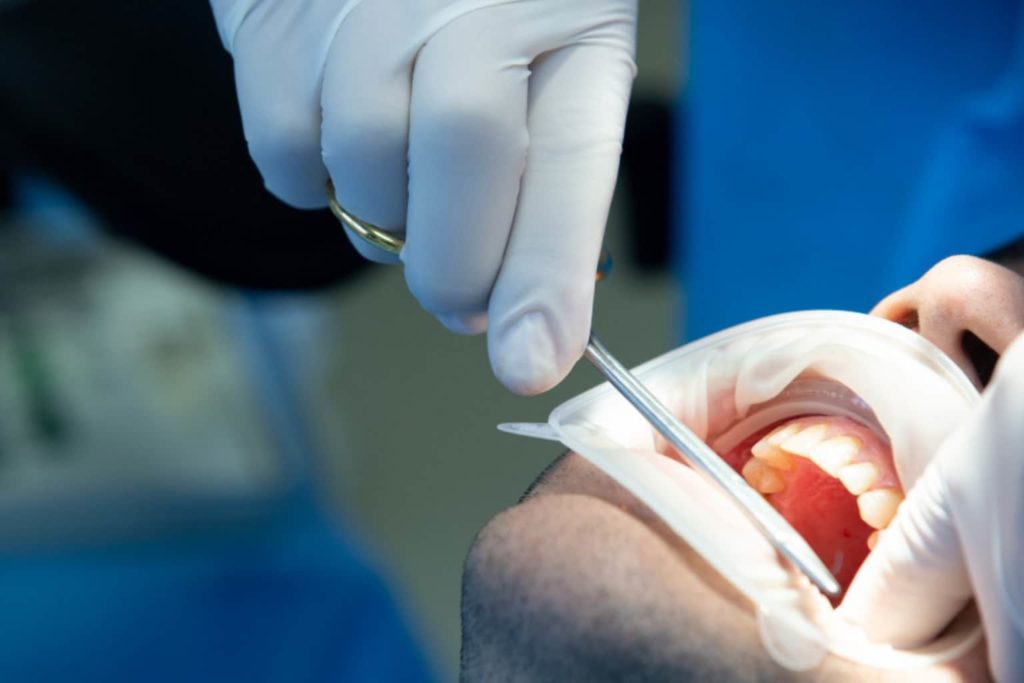 Best Dentist in Gaur City Noida Extension, Dental Clinic Gaur City